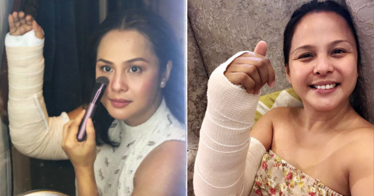 Nikki Valdez, recovering from ‘freak accident,’ learns to do makeup ...