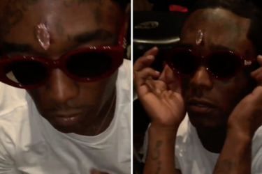 LOOK: Lil Uzi Vert shows off $24-million diamond forehead implant ...