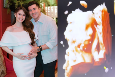 LOOK: Jessy Mendiola, Luis Manzano give glimpse of baby's face | Inquirer Entertainment