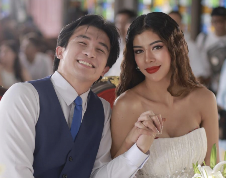 Herlene Budol sought professional help after Rob Gomez scandal