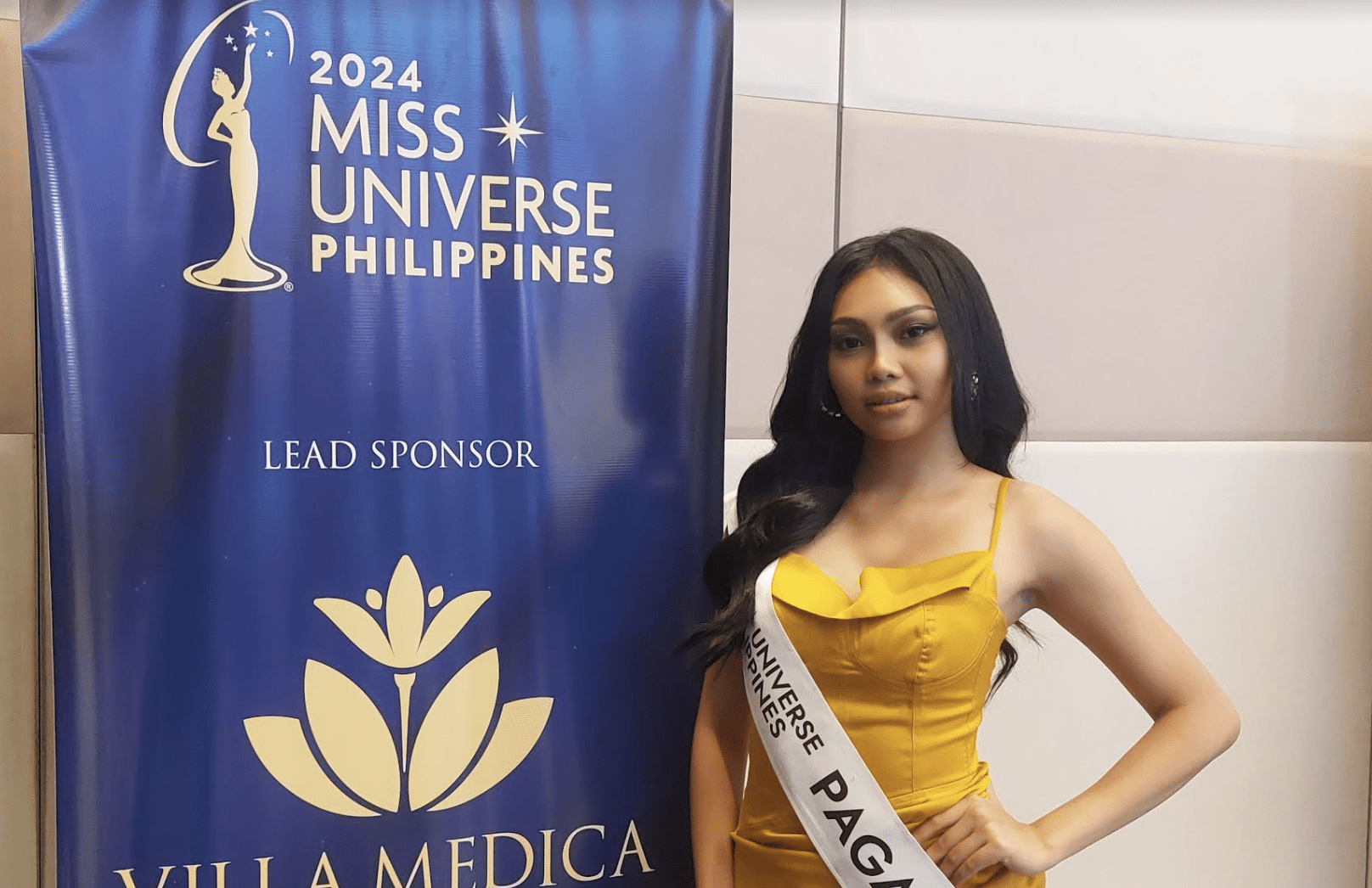 Ang taya ng Miss Universe Philippines ay nagpapakita ng epilepsy na ...