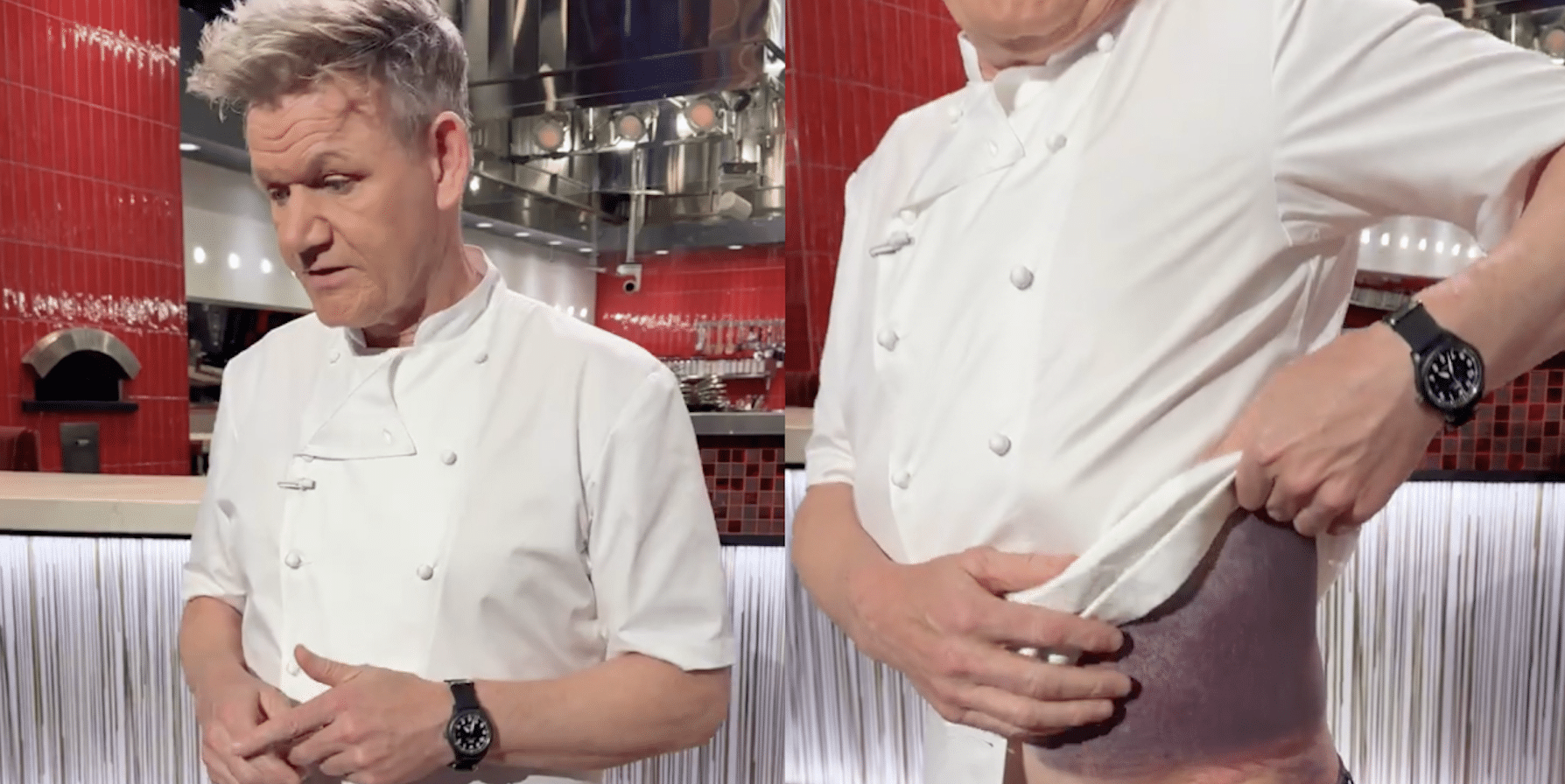 Si Gordon Ramsay ay nagtamo ng matitinding pasa matapos ang halos ...