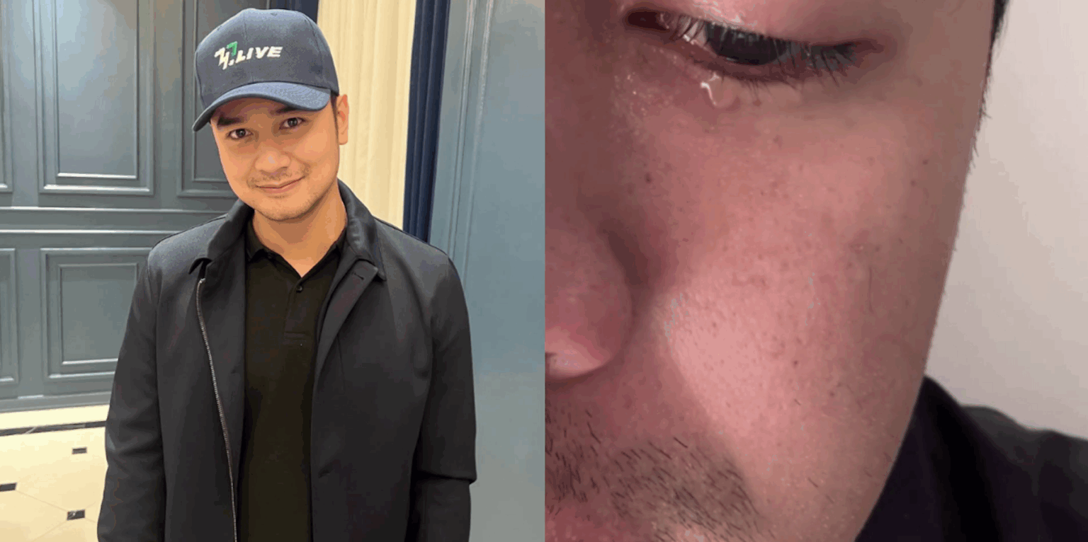 JM de Guzman worries netizens after crying post on Instagram