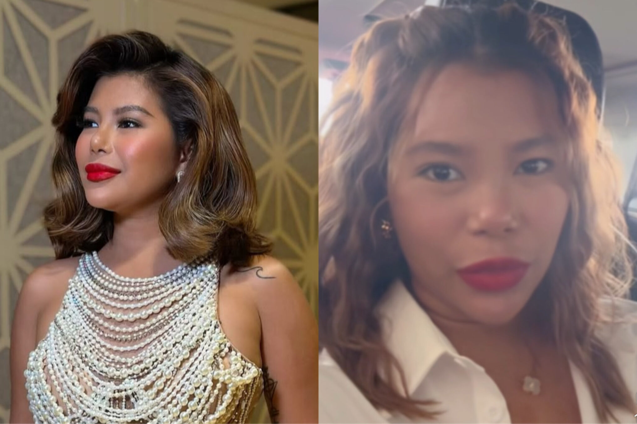 Katrina Velarde removes nose implant after suffering complication