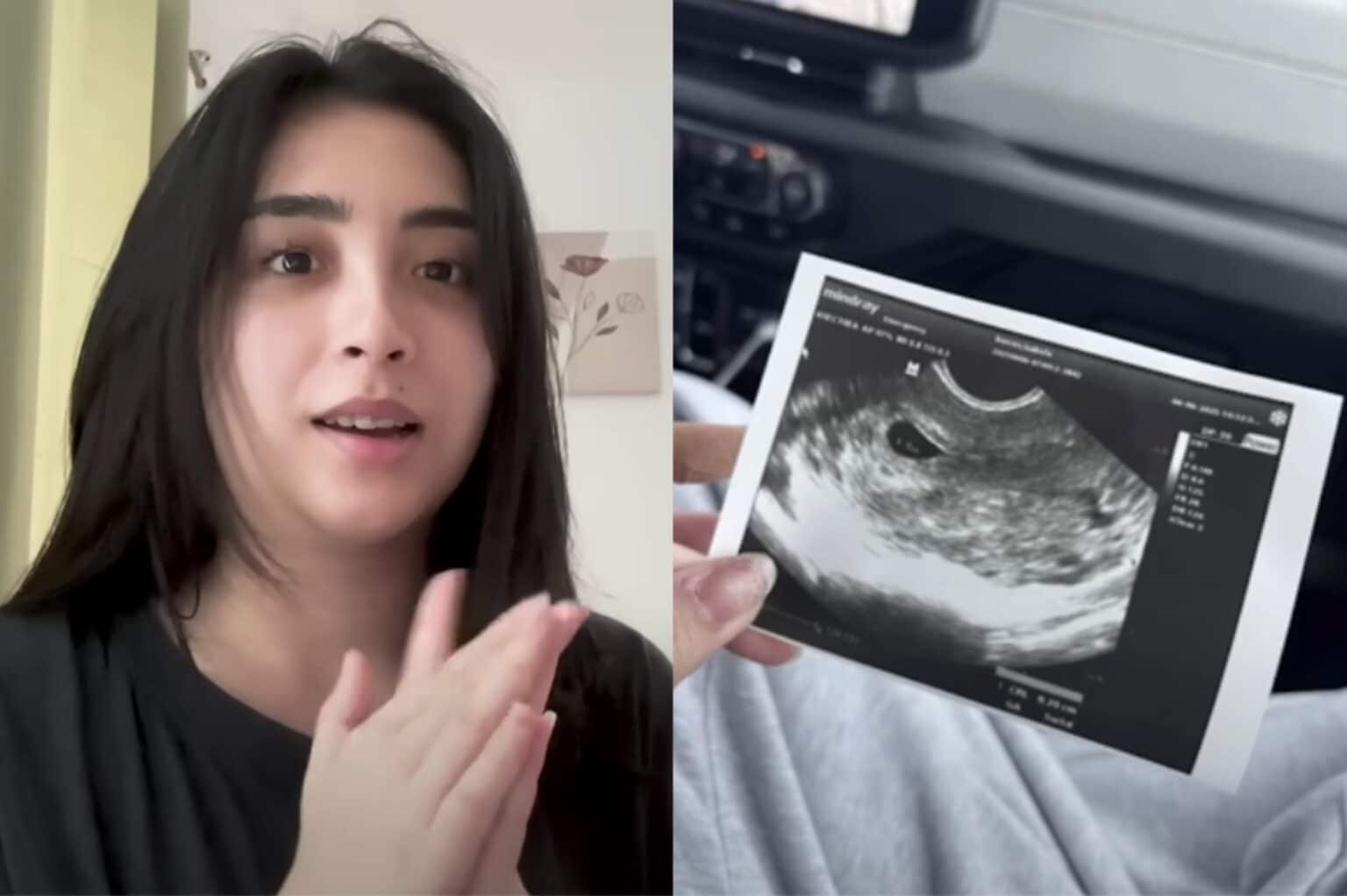 Bea Borres announces pregnancy